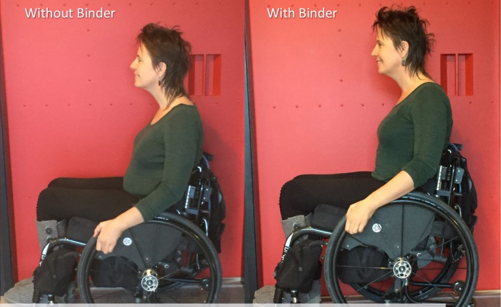 Preventing asymmetrical posture with a Corset - Morton & Perry